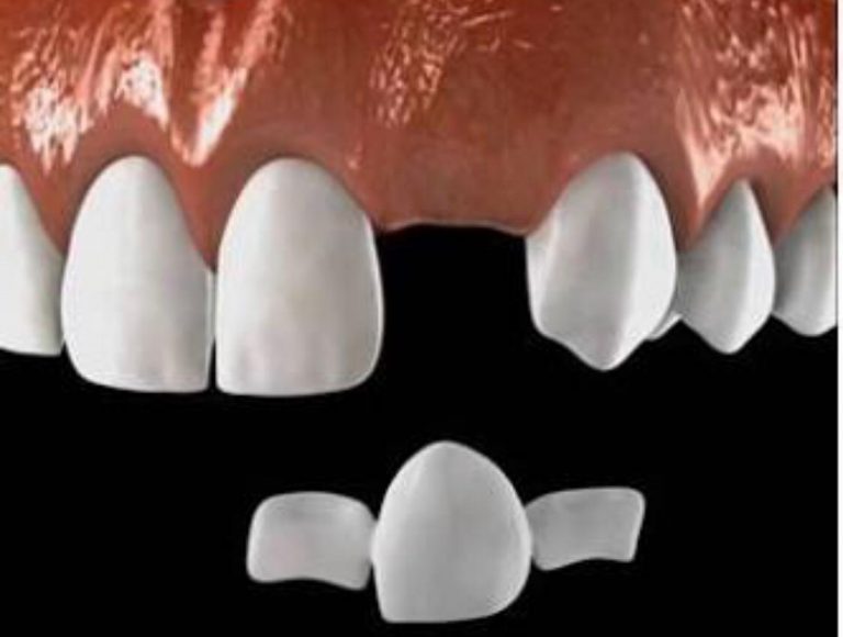 Reabilitação oral • Clermont Odontologia